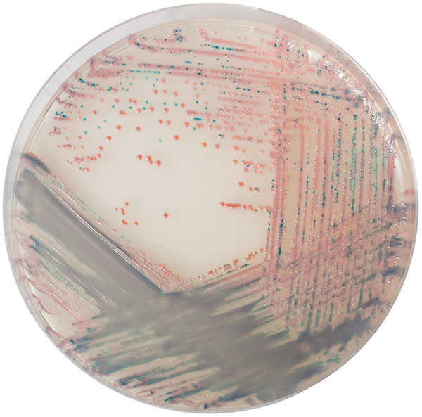 CHROMagar Streptococcus Fertigplatten