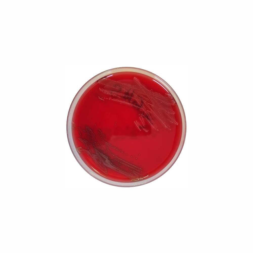 Mueller-Hinton-II-Agar mit 5 % Pferdeblut + 20 mg/l NAD EUCAST ...