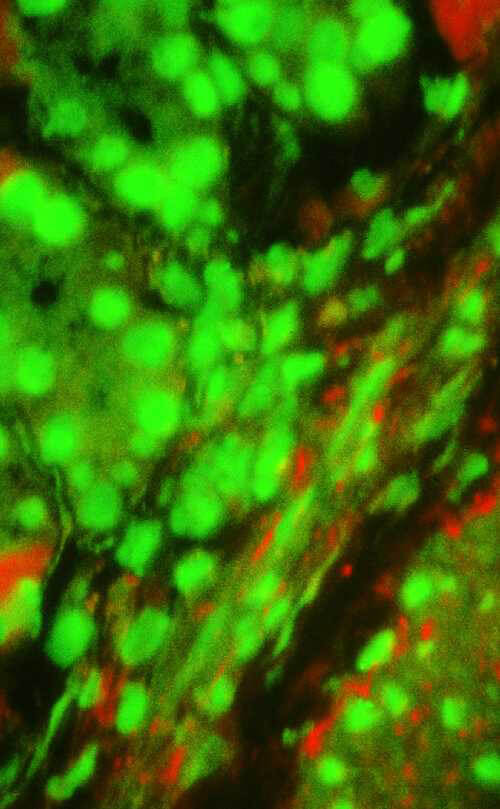 ANA/AMA/ ASMA/APCA/LKM TISSUE SECTIONS