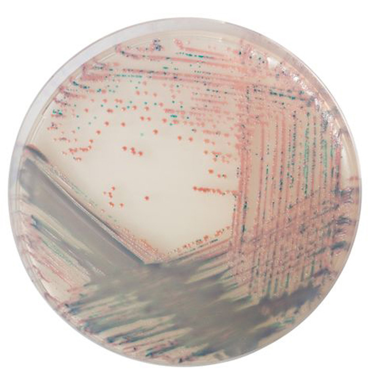 CHROMagar Staph.aureus Fertigplatten