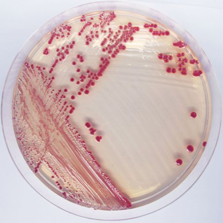 CHROMagar Acinetobacter (5L)