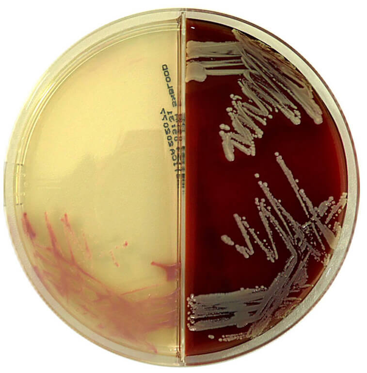 CHROMagar MRSA/Columbia-CNA+5% Schafblut